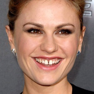 8 Gorgeous Women With 'Bad' Teeth - ZergNet