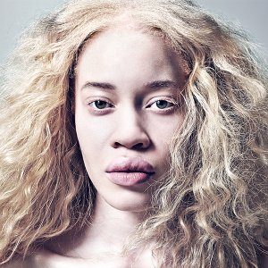 First Model With Albinism Lands Her Own Major Beauty Campaign - ZergNet