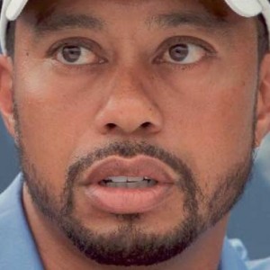Tiger Braces For Inevitable Baldness - ZergNet