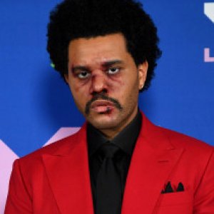 The Real Reason The Weeknd's Face Was Bloody at the VMAs - ZergNet