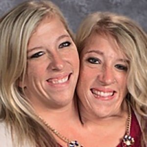 What You Don't Know About The Hensel Twins - ZergNet