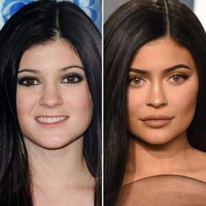 Kylie Jenner Gets Real About Her Changed Appearance - ZergNet