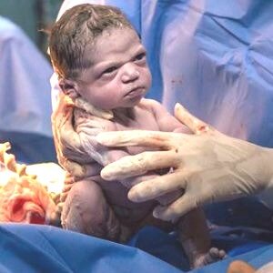 The Brazilian Baby That Became An Internet Sensation - ZergNet